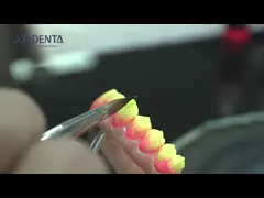 China Veneers Made With High Fracture Resistance Dental Zirconia And Multilayered Gradient Technology for sale