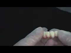 China Porcelain All On Four Zirconia Bridge High Esthetics Dental Implant Bridge for sale