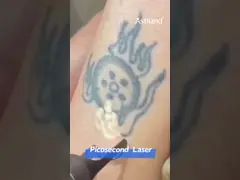 China 7 Jointed Articulated Arm Red Diode Laser Machine 1064nm For Tattoo for sale