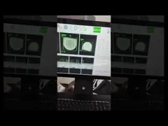 Riconoscimento visivo di immagine di AI della macchina di ispezione di qualità della linea di riempimento liquida