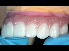 Cina Impianto dentale di zirconio professionale Corona di titanio CAD CAM Corona di zirconio Laboratorio dentale cinese in vendita