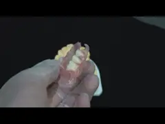 Cina Denti d'Asso Rosa/Oscuro TCS Valplast Protesi parziali flessibili per alta estetica Modello di stampa 3D dentale in vendita