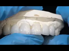 Precise Zirconia Crown Bridge Comfortable Fit / Esthetics 3-4 Days Quick Turnaround Time