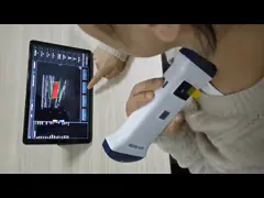 China 2025 Best Handheld Ultrasound | NMPA Approved with HD Frame Rate for sale
