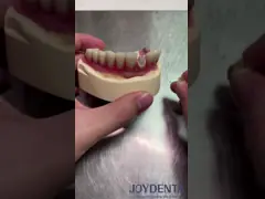 Dentes temporários de resina amarela Tratamento da superfície lisa Precisa e estável