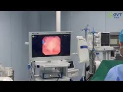 XXX Hospital Update: Dr. Sun Prefers Our Flexible Ureteroscope for Better Visualization