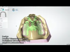 Biocompatibility Dental Telescope White Inner Zirconia Outer Peek Telescope Dental