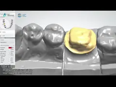 China Natural Tooth Color Ceramic Feldspathic Veneer For Anterior And Posterior Teeth for sale