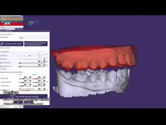 China 3D Printed Soft Occlusal Splints For Bruxism Comfort Dental Occlusal Splint for sale