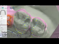 China High Strength 3D Printed Titanium Framework With Clear Clasps For Durable Performance for sale