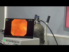 Single- use Digital Flexible Cholangioscope DU503810R