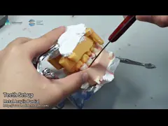 China Removable Metal Acrylic Partial Denture With Clasps For Partial Chewing for sale