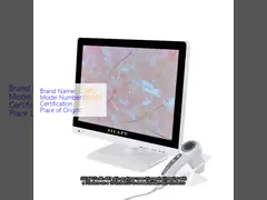 Tri-spectral Imaging Skin Analyzer 15 Inch LCD Screen AC 110V 60Hz Input Voltage Advanced Technology