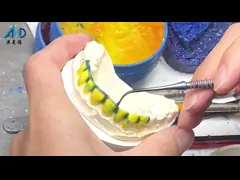 China Porcelain Shade Ultra Thin EMAX Veneers Stain Resistant For Aesthetic Restorations for sale