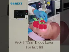 엔도 리프트 1470nm 엔도 레이저 980nm 듀얼 레이저 엔도 목 꽉 최소 침습 다이오드 레이저 치료 기계