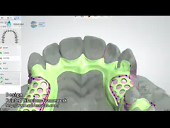 Hypoallergenic Adjustable And Customizable 3D Printed Titanium Framework With Modern Design