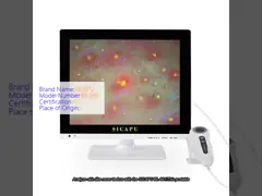 15” Tri-spectral Digital Skin Analyzer: Multi-Spectral Tech to Analyze Epidermis, Dermis & Subcutaneous Layers