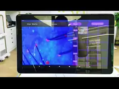 China AI Hair Analysis Testing Machine Android 10 50hz / 60hz Hair And Scalp Testing Machine for sale