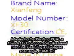 15인치 LED 컬러 휴대용 초음파 기계, 60도 스캔 각도 및 구성 프로브 2.0MHz-5.0MHz