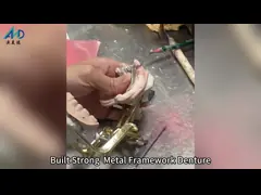 China Easy Fit Custom Cast Partial Denture Stable and Natural-looking Framework for Fast Results for sale