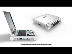 SVGA Video Output Ultrasound Scanning System for Accurate Scans and 2 USB Ports