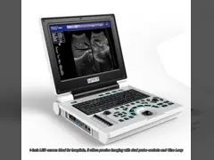 Advanced Technology Ultrasound Scanning Machine with 4 Focus and Long-Lasting Li-ion Battery