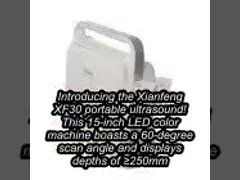 15인치 LED 컬러 휴대용 초음파 기계, 60도 스캔 각도 및 ≥250mm 깊이 표시