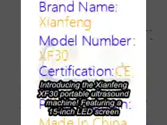 15 인치 LED 컬러 휴대용 초음파 기계 60도 스캔 각도 및 ≥250mm 깊이 디스플레이