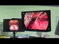 高解像度 使い捨て 柔軟性 エンドスコープ 胆管診断 単身用 エンドスコープ