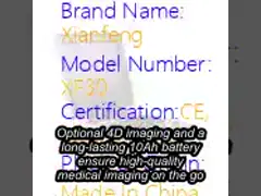 Portable Ultrasound Machine with 8 TGC Control 10Ah Battery and ≥250mm Depth Display for High-Quality Medical Imaging