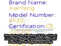 15 Inch LED Color Portable Ultrasound Machine with 60deg Scan Angle and Configuration Probe 2.0MHz-5.0MHz