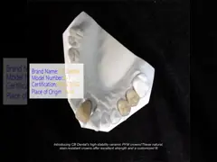 China High Stability Ceramic Dental PFM Crown Natural Tooth Stain Resistant for sale