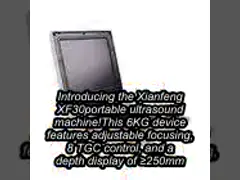 깊이 디스플레이 ≥250mm 8 TGC 제어 및 선택 배터리 10Ah 14.4V