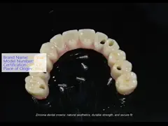 China Zirconia Dental Crown: Natural-looking Teeth, Durable & Secure for sale