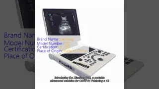 China P20 Portable Laptop Ultrasound System with 12.1" Display and 3200mAh Battery for OB/GYN Applications for sale