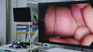 China Medical Video Full HD Endoscope Camera Integrated HD Imaging Flexible Endoscope Camera for sale