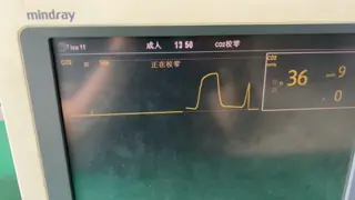 China Mindray Water Trap For 9200-10-10530 Adult Pediatric Anesthesia Gas Module for sale