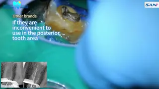 SANI Dental Mirror