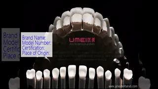 Natural Veneers For Perfect Smile