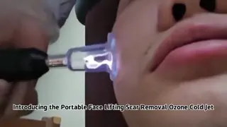 Ozone Jet Fusion Cold And Warm Plasma Machine For Skin Tightening Wrinkle Removal