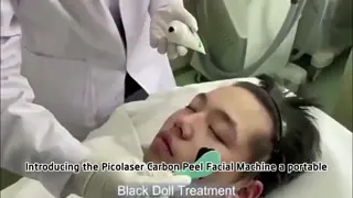 Picosecond Nd Yag Laser Machine For Freckles Removal Eyebrow Removal