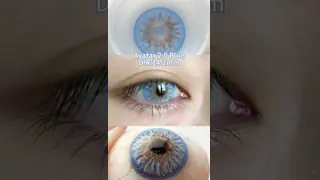 Avatar 2.0 Blue 14.2mm