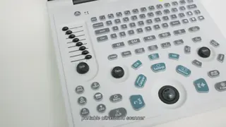 saferlife medical equipment Ultrasound scanner