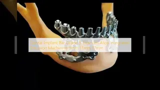 Titanium Dental Implant Bar Precision Machined
