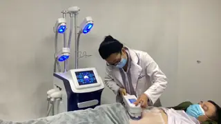 Which cryolipolysis machine can treat belly fat
