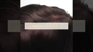 Medium Brown French Lace Hair System 9x11