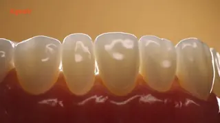 Kyozir Alpha+ Zirconia High Translucency Dental Blocks Production Process