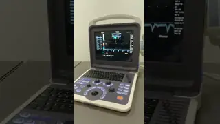 BR-US22 Ultrasound machine