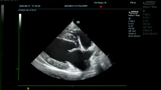 New Compatible Mindray P8 2s Animal Ultrasound Probe