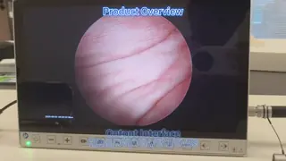 Portable 13.3 Inch 1080P Endoscopy Camera System With Recorder for Laparoscopy ENT Surgery